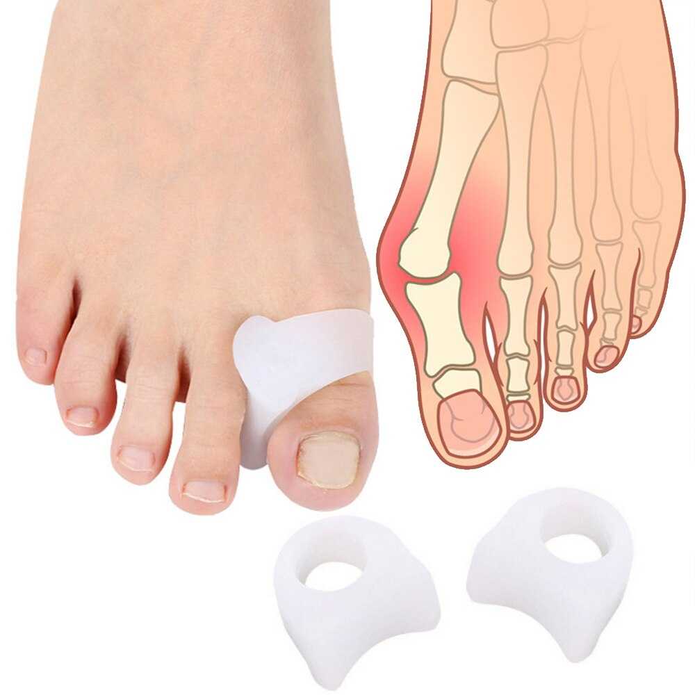 Jual Sumifun Sleeve Korektor Tulang Jempol Bunion Hallux Valgus